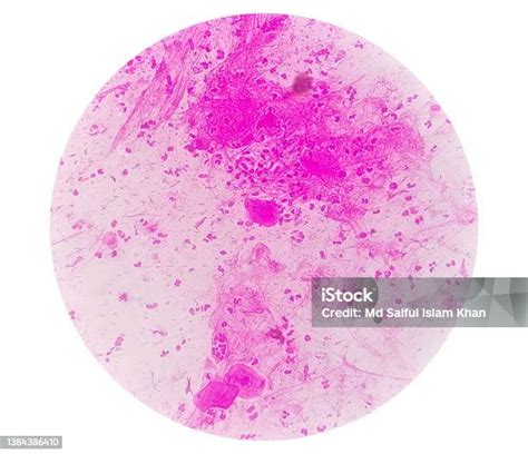 그램 얼룩 그램 양성 코치 그람 양성 디플로코치 박테리아 와 현미경 검사의 편평상피 건강관리와 의술에 대한 스톡 사진 및 기타 이미지 건강관리와 의술 과학 과학