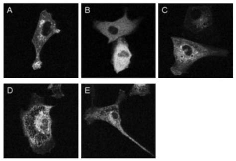 Subcellular Distribution Of Egfp Labeled Wild Type Chimeric And Download Scientific Diagram