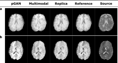 Figure 8 From Image Synthesis In Multi Contrast Mri With Conditional Generative Adversarial