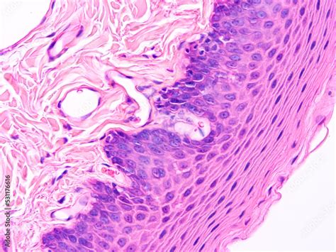 Histology Of Human Tissue Show Epithelial Tissue And Connective Tissue