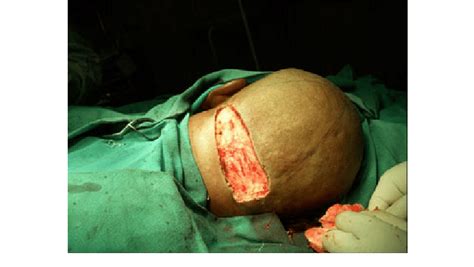 Orientation Of Flap Design Download Scientific Diagram