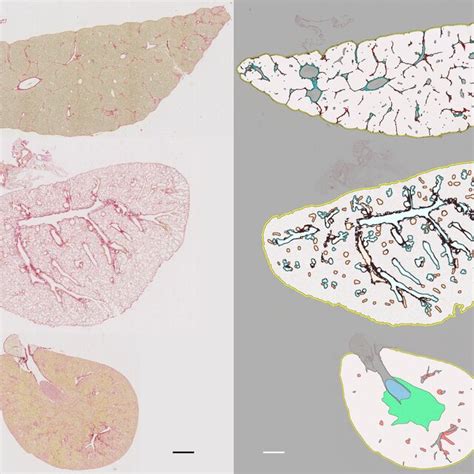 Computer Assisted Segmentation Of Histological Structures In The Three Download Scientific