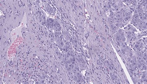 Cellular Immunology Services Mpln