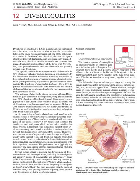 Acs0512 Diverticulitis 2004 Pdf