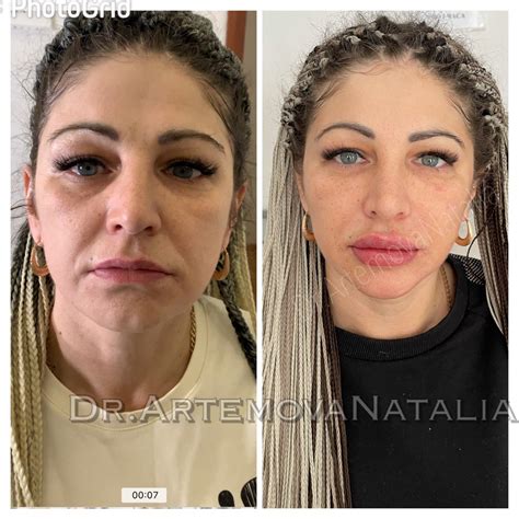 Косметолог Новосибирск