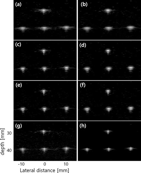 Estimation And Suppression Of Side Lobes In Medical Ultrasound Imaging Systems Pmc