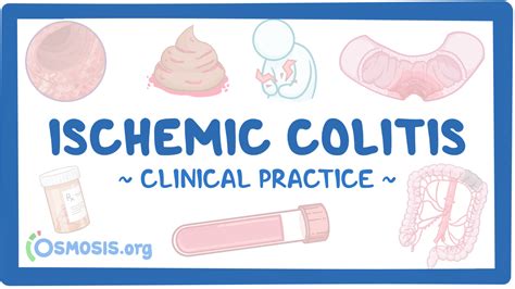 Ischemic Colitis Video And Meaning Osmosis