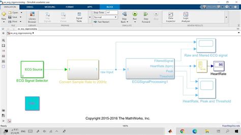 X Execgsigprocessingecgsignal Processing 1