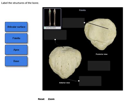 Solved Label The Structures Of The Bone Chegg Com