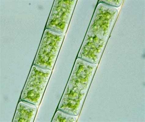 Protist Images Filamentous Algae