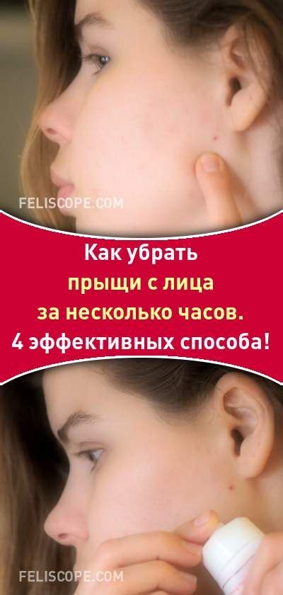 Как убрать прыщи с лица за несколько часов 4 эффективных способа