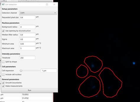 cell detection issues in qupath image analysis image sc forum