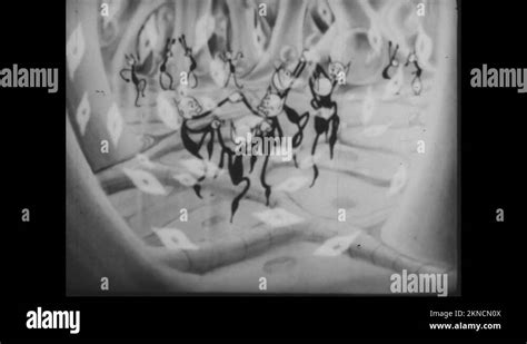 Tuberculosis Interior Stock Videos And Footage Hd And 4k Video Clips