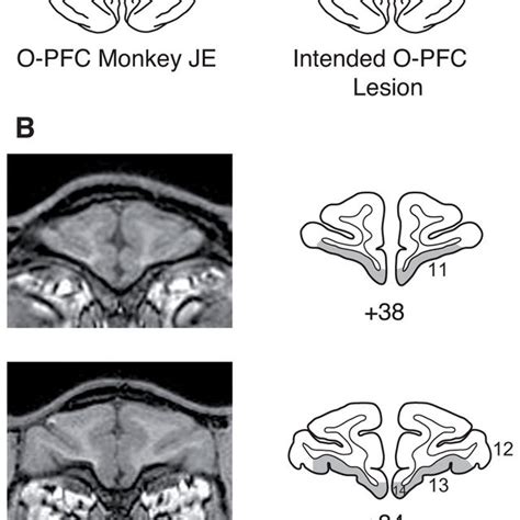 Lesions Of Orbital Prefrontal Cortex O Pfc A Ventral View Of A Download Scientific Diagram