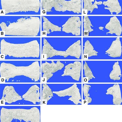 Three Dimensional Micro Ct Reconstructed Images Showing The Ability Of