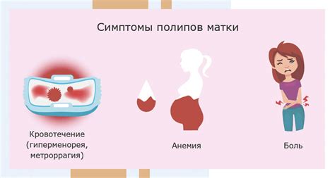 Полип в матке: причины, симптомы, способы лечения полипа эндометрия матки