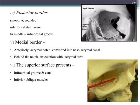 Surgical Anatomy Of Periodontal Structures Pptx