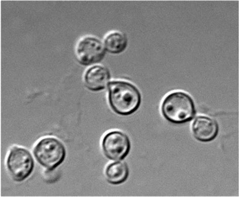 Figure 1 From Cryptococcus Semantic Scholar
