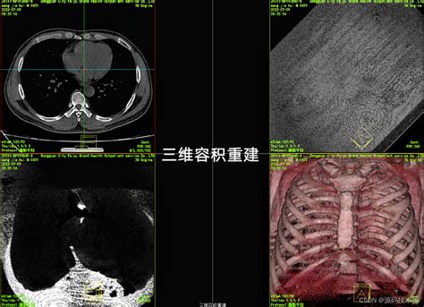 c 医院影像科pacs源码：三维重建、检查预约、胶片打印、图像处理、测量分析等 c 医疗项目 csdn博客