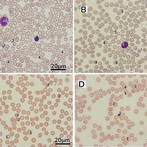 Overview Of Erythrocyte Size And Morphological Alterations AControl Download Scientific