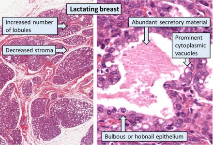 Breastfeeding Wikipedia