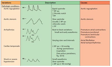 Arterial Line Waveform Interpretation