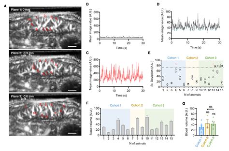 Imaging And Quantification Of The Hepatic Vasculature Of Mice Using