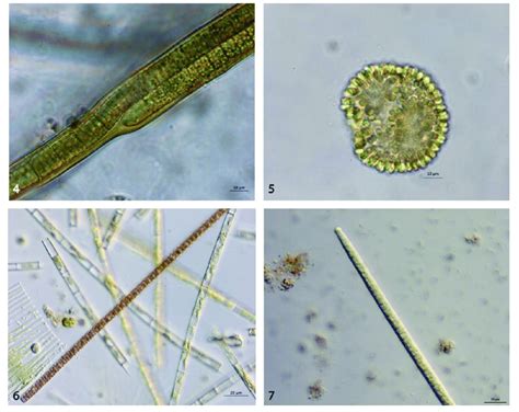 The Chemical Structure Of Microcystin 1 And The Species Which Produce