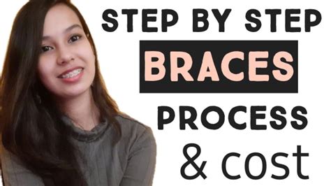Braces Step By Step Process My Braces Journey Whole Braces Process My