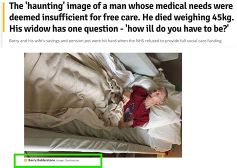 Fact Check ‘mr Bean Bedridden Manipulated Photo Of Rowan Atkinson Goes Viral