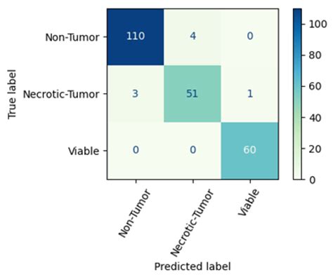 Adapted Deep Ensemble Learning Based Voting Classifier For Osteosarcoma Cancer Classification