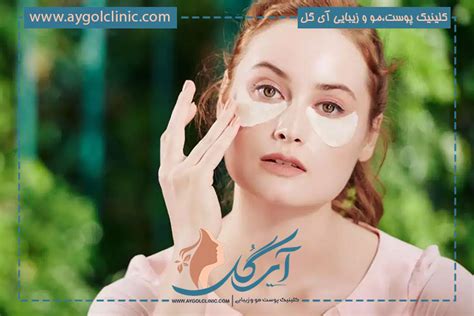 سیاهی دور چشم از چیست؟ روش‌های خانگی و کلینیکی برای درمان آی گل