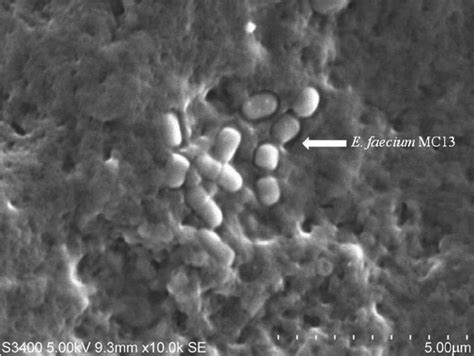 Scanning Electron Micrograph Of Enterococcus Faecium Mc13 Showing Download Scientific Diagram