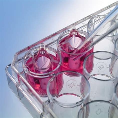 Co Culture In Thincert Cell Culture Inserts