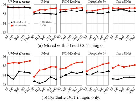 Figure 5 From Retinal Oct Synthesis With Denoising Diffusion