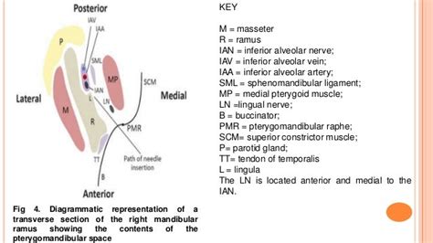 Pterygomandibular Space