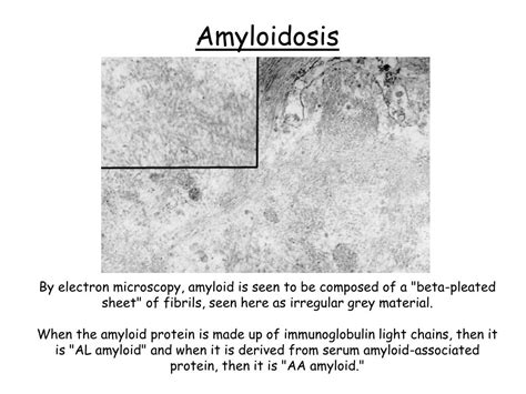 PPT Amyloidosis PowerPoint Presentation ID 470669