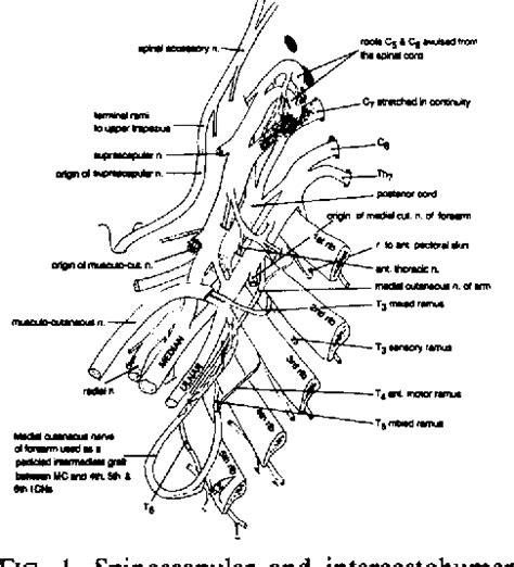 Figure 1 From Neurotization In Brachial Plexus Injuries Semantic Scholar