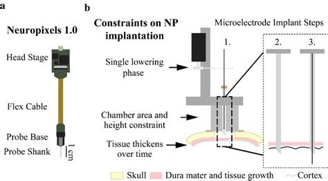 Conventional Microelectrode Recordings And Associated Design