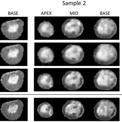 Three Examples Of Real And Reconstructed Images Using The Vae β Vae