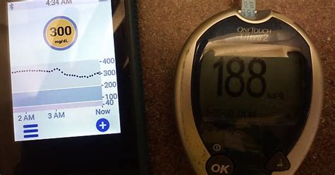 Dexcom Album On Imgur