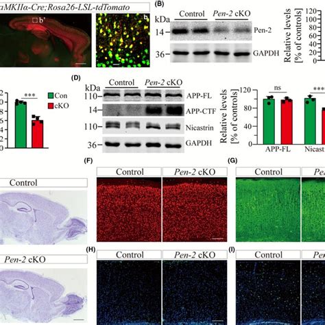 Molecular Characterization Of Forebrain Neuron‐specific Pen‐2 Cko Mice Download Scientific
