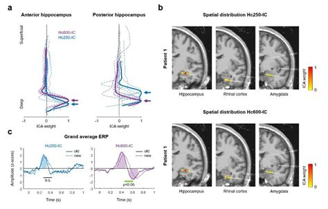 Two Hippocampal Sources During Memory Recognition Download