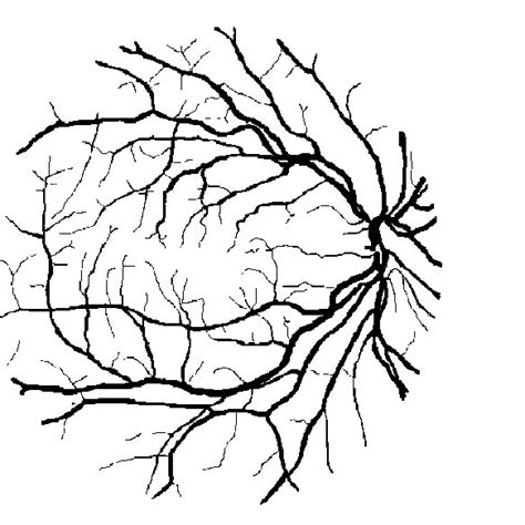 Retinal Vessel Segmentation Using Resnet Unet A Actual Image B Download Scientific Diagram
