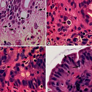 Sections Of The Upper Jejunum Showing Various Developmental Asexual Download Scientific