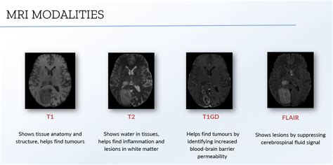 github gelsonm 3d brain mri detection