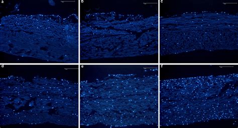 Proliferation And Migration Of Chondrocytes In The Membrane Without Download Scientific Diagram