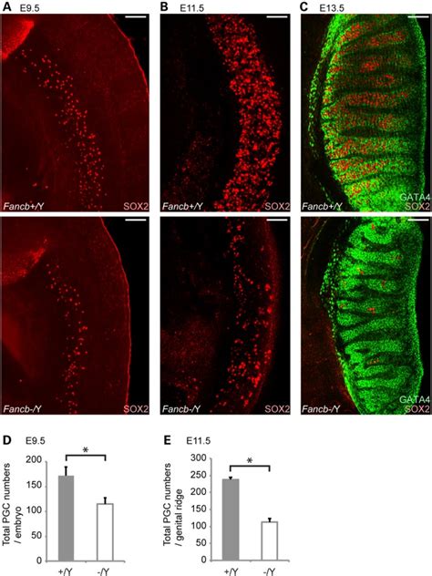 Fancb Is Essential In The Male Germline And Regulates H3k9 Methylation