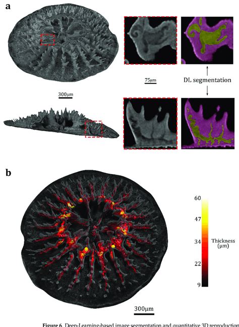Deep Learning Based Image Segmentation And Quantitative 3d Reproduction