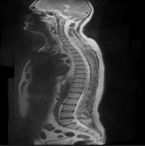 application in medical images · issue 91 · fenglinglwb mat · github